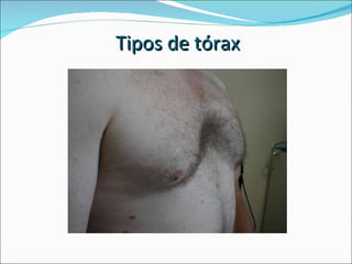 Semiologia do Sistema Respiratório - Dra. Ana Paula Barreto | PPT