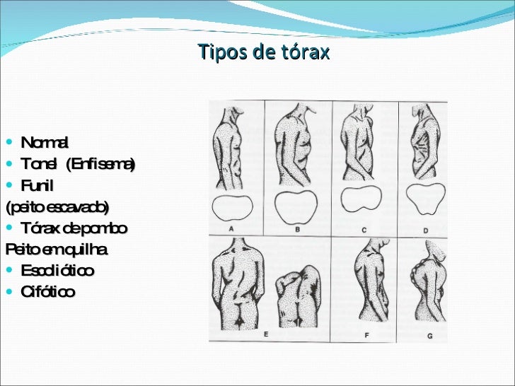 Semiologia do Sistema Respiratório - Dra. Ana Paula Barreto