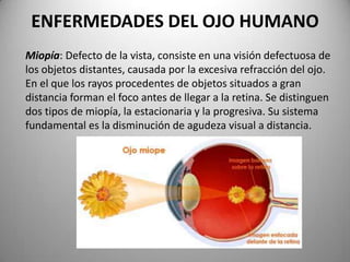 Sistema sensorial de la vista | PPT