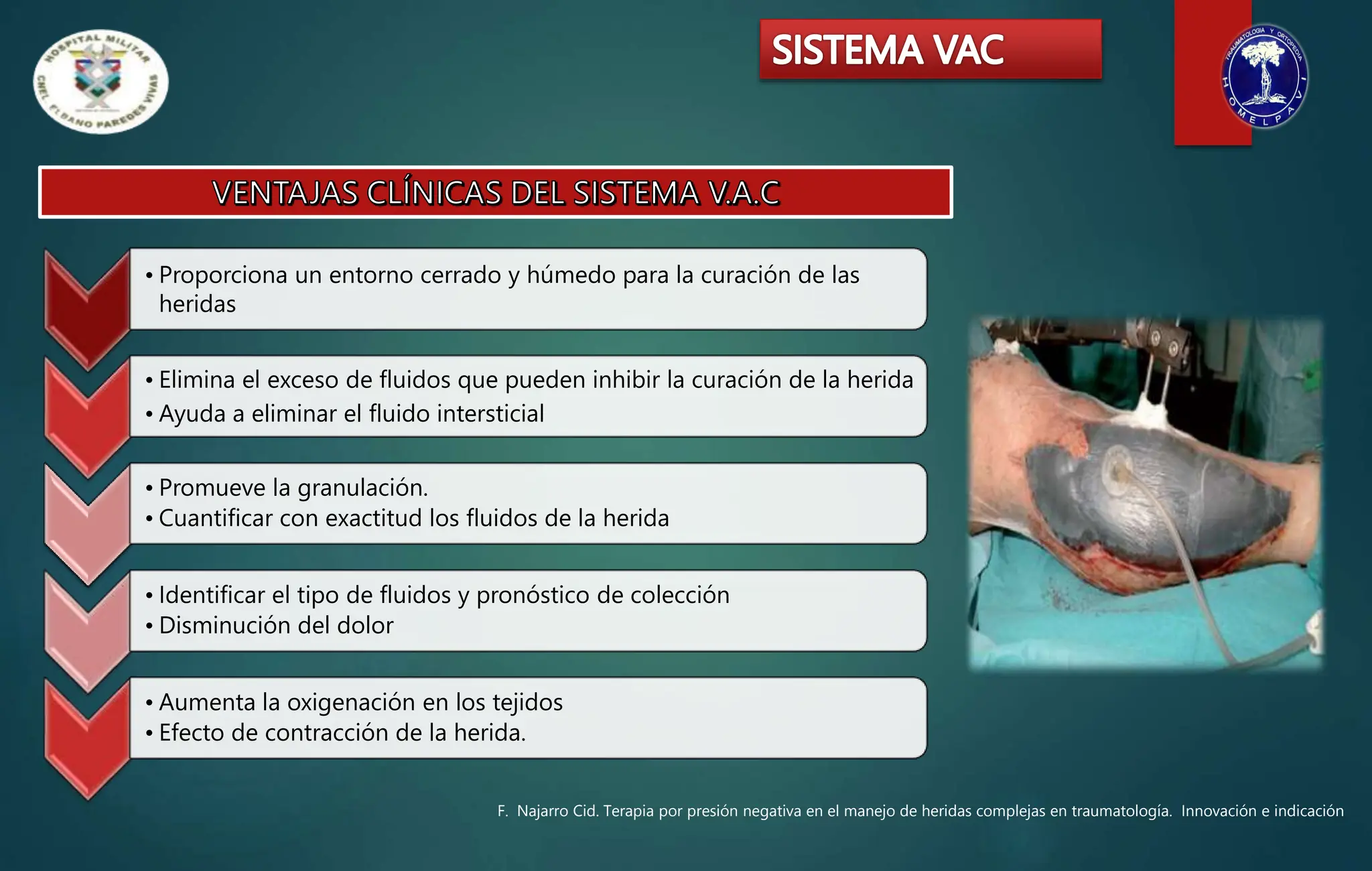sistema vac 1.pptx