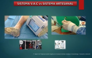 sistema vac 1.pptx