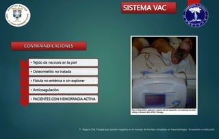 sistema vac 1.pptx