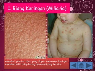 Sistem ekskresi | PPTX