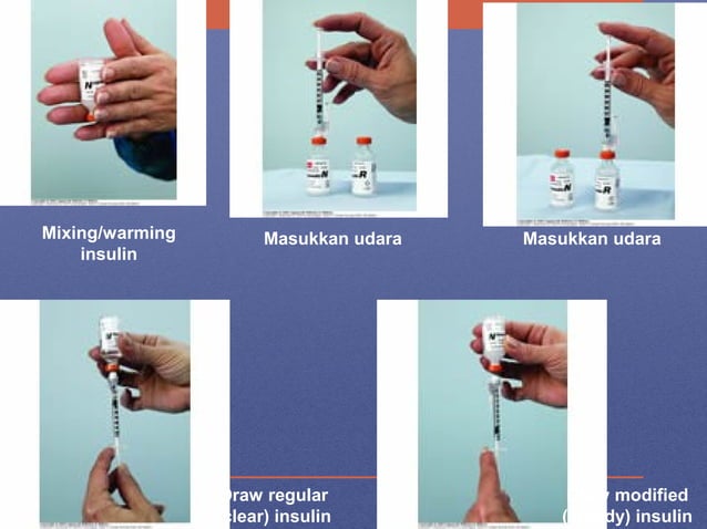 SISTEM ENDOKRINA - Terapi Insulin | PPT