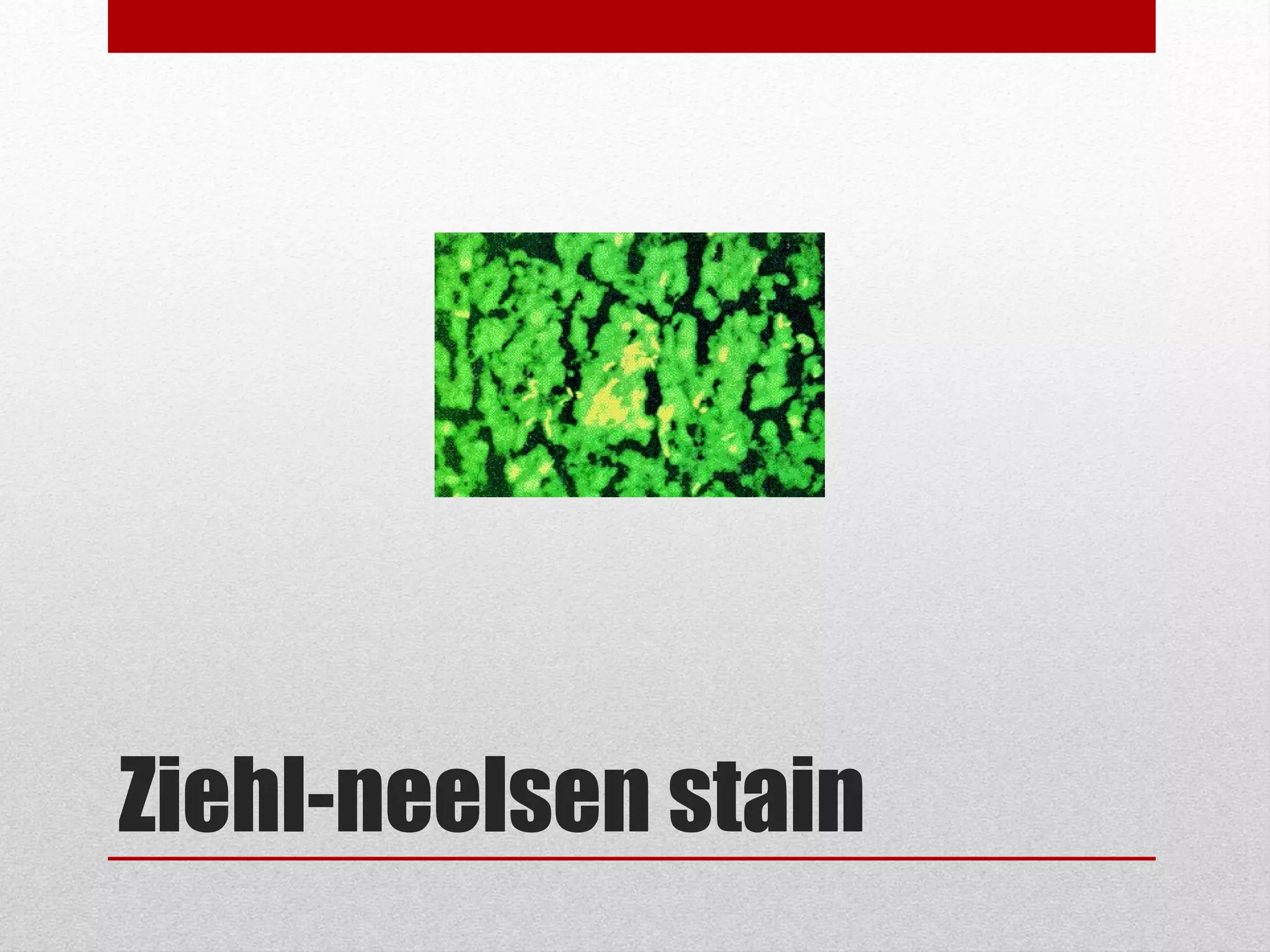 SISTEM GENITO URINARI - BAKTERIOLOGI | PPT