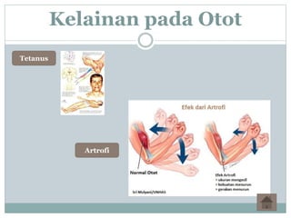 Sistem gerak (otot) | PPTX