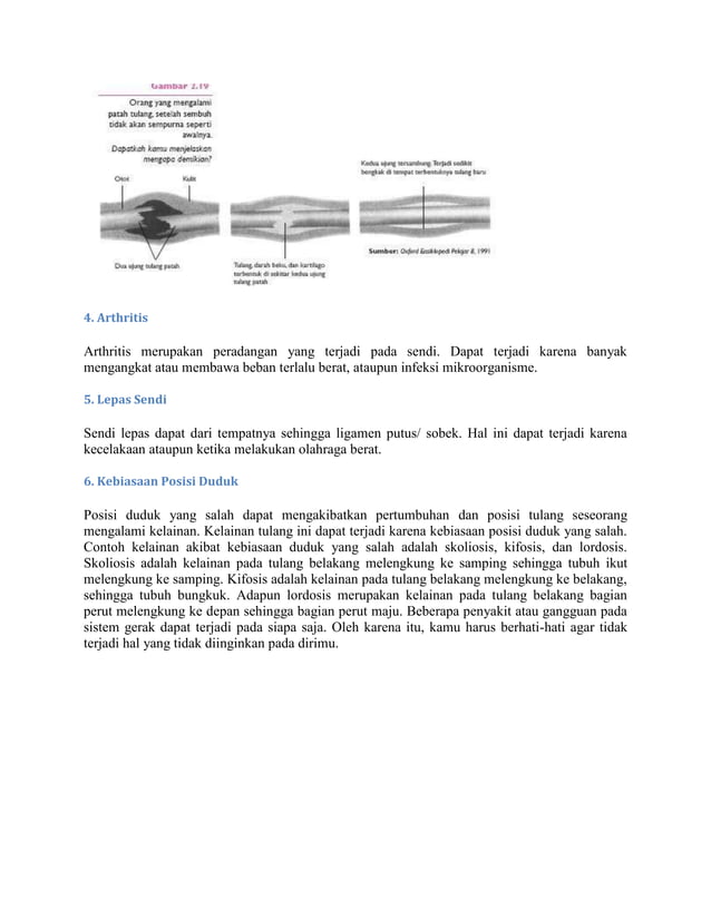 Sistem gerak pada manusia | PDF