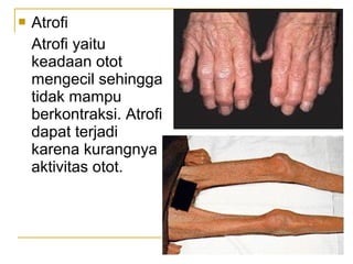 SISTEM GERAK PADA MANUSIA KELAS XI IPA | PPT