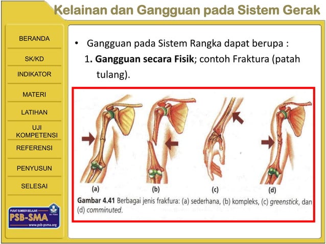 SISTEM_GERAK_XI_IPA.ppt