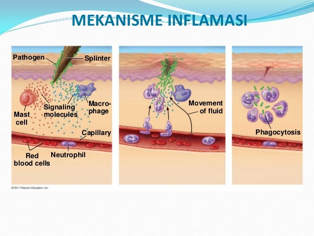 Sistem imunitas bawaan (non spesifik respon)