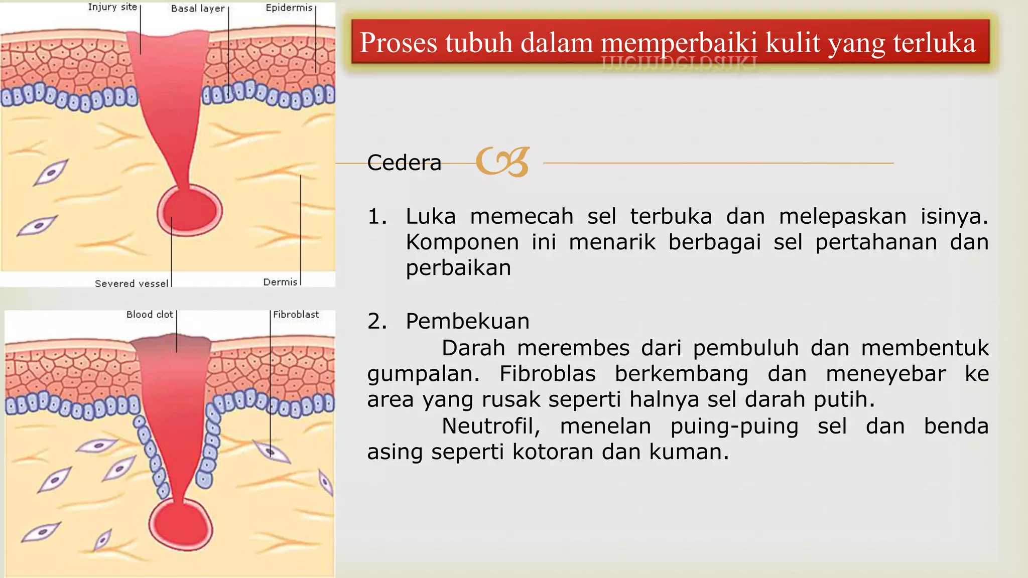 SISTEM INTEGUMEN KELOMPOK 2.pptx