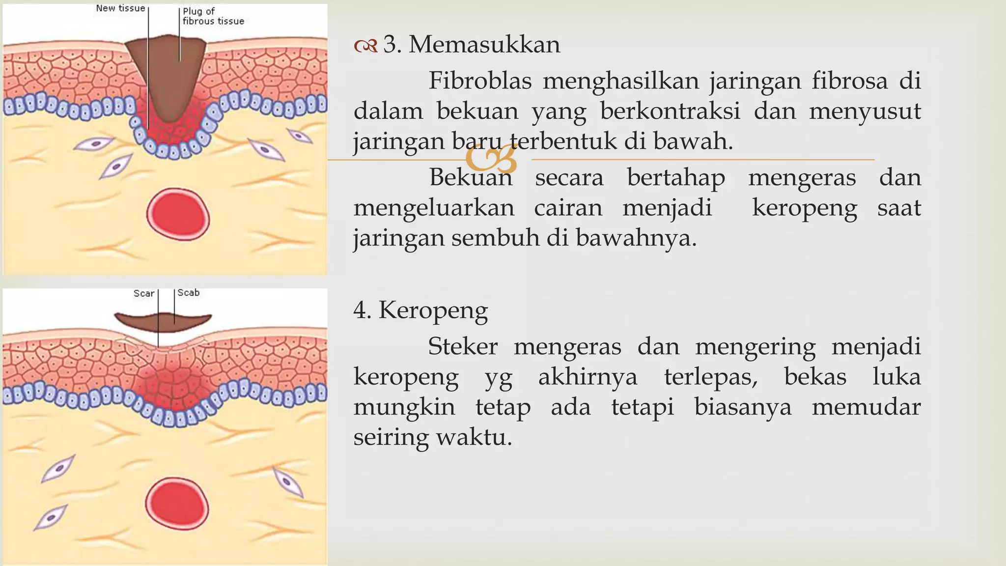 SISTEM INTEGUMEN KELOMPOK 2.pptx