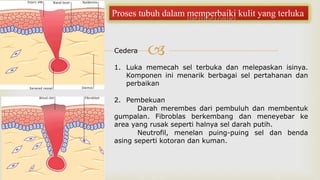 SISTEM INTEGUMEN KELOMPOK 2.pptx