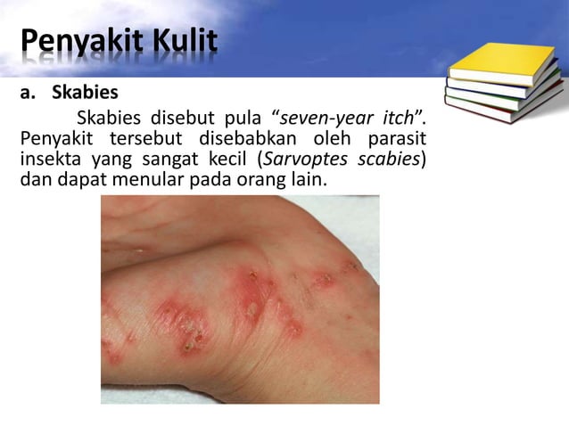 Sistem Integumen | PPTX