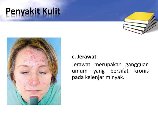 Sistem Integumen | PPTX