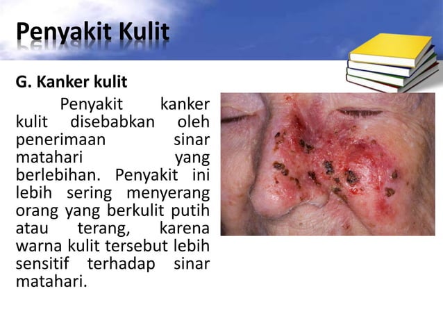 Sistem Integumen | PPTX