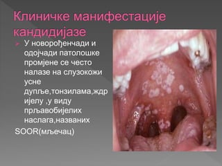 Sistemne mikoze | PPTX