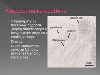 Sistemne mikoze | PPTX