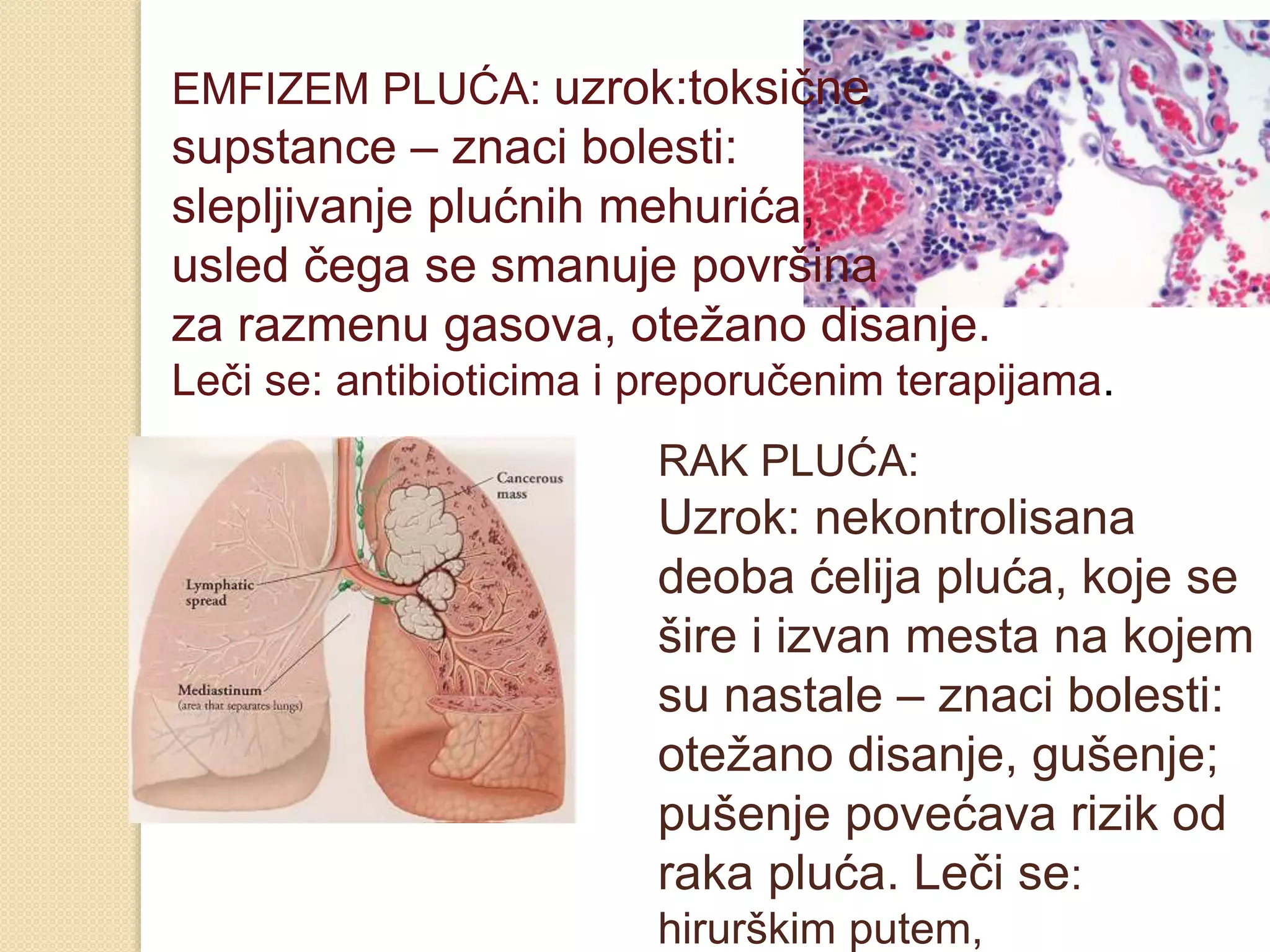 Sistem organa za disanje | PPTX