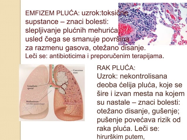 Sistem organa za disanje | PPTX