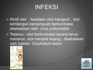 Sistem otot | PPTX