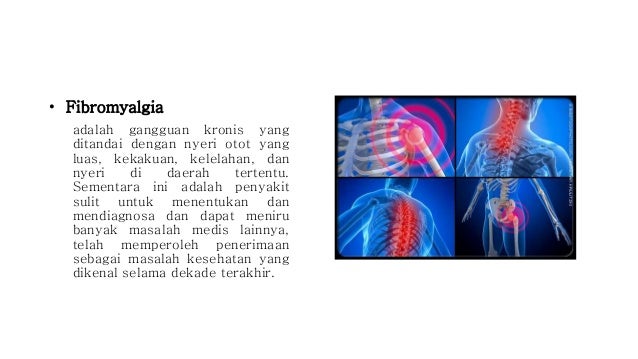 Sistem Otot pada Manusia