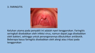 Sistem pernafasan manusia gangguan pernapasan kelas 8 | PPTX