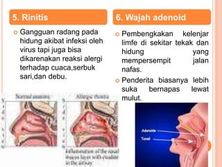 sistem pernapasan pada manusia.ppt