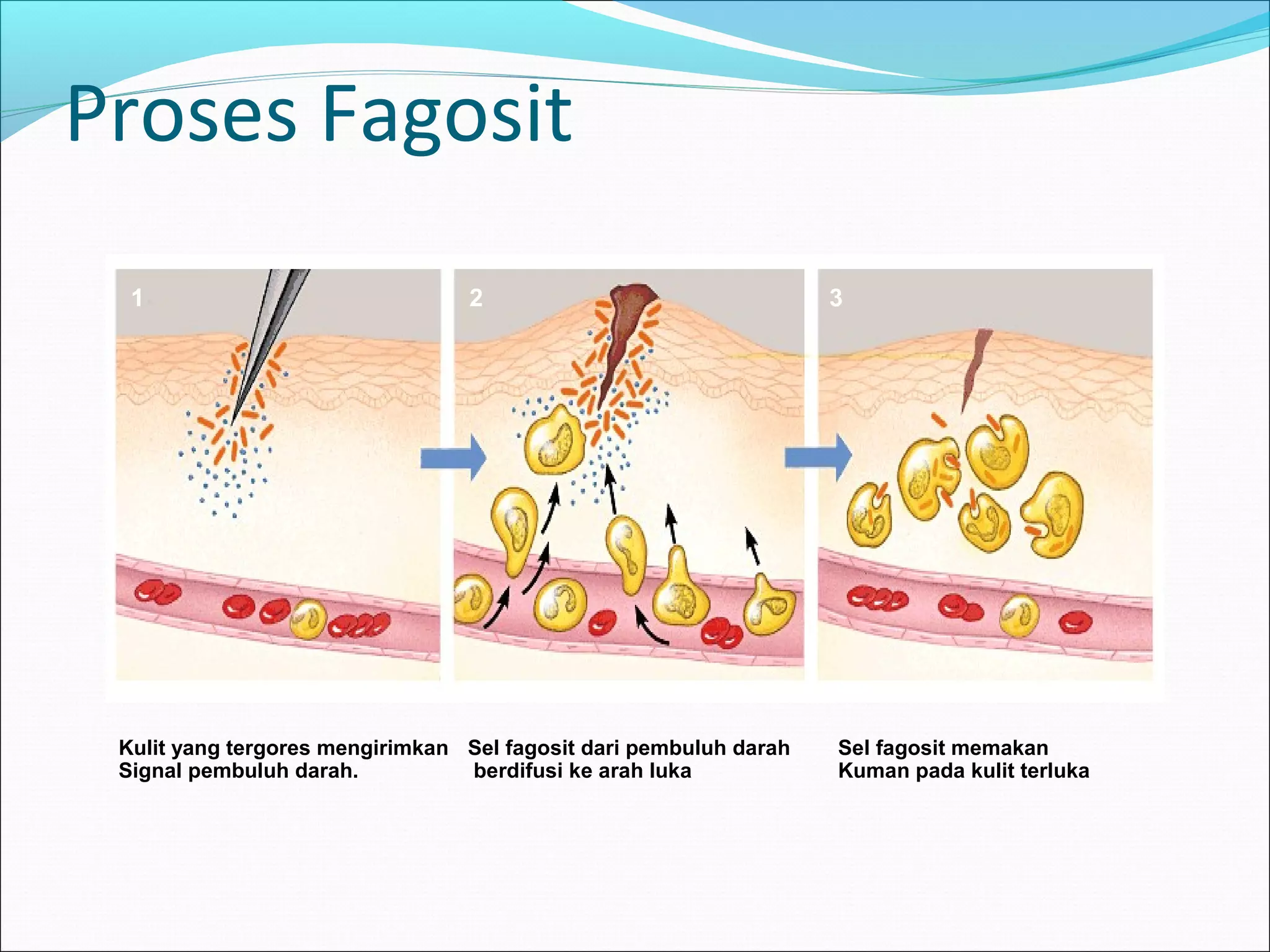 Sistem pertahanan tubuh | PPT