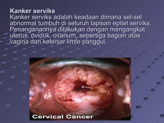 Sistem reproduksi pada manusia | PPT
