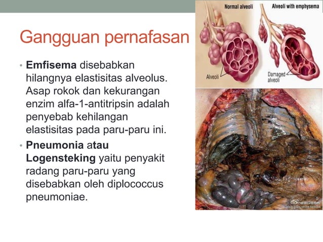 Sistem_respirasi.ppt