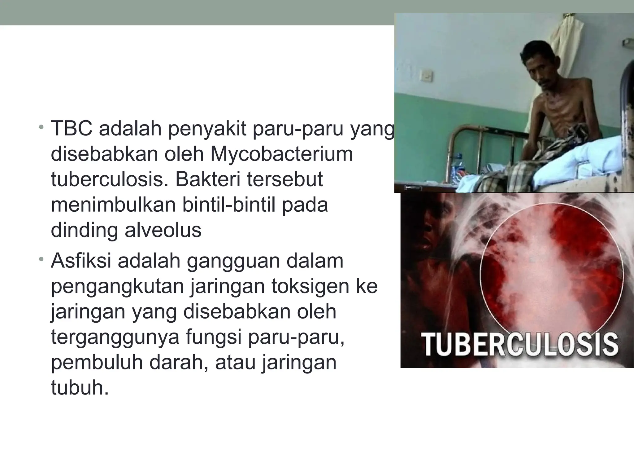 Sistem respirasi pada manusia dan kelainan sistem respirasi | PPT