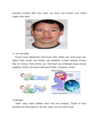 Sistem Saraf Otonom | DOCX