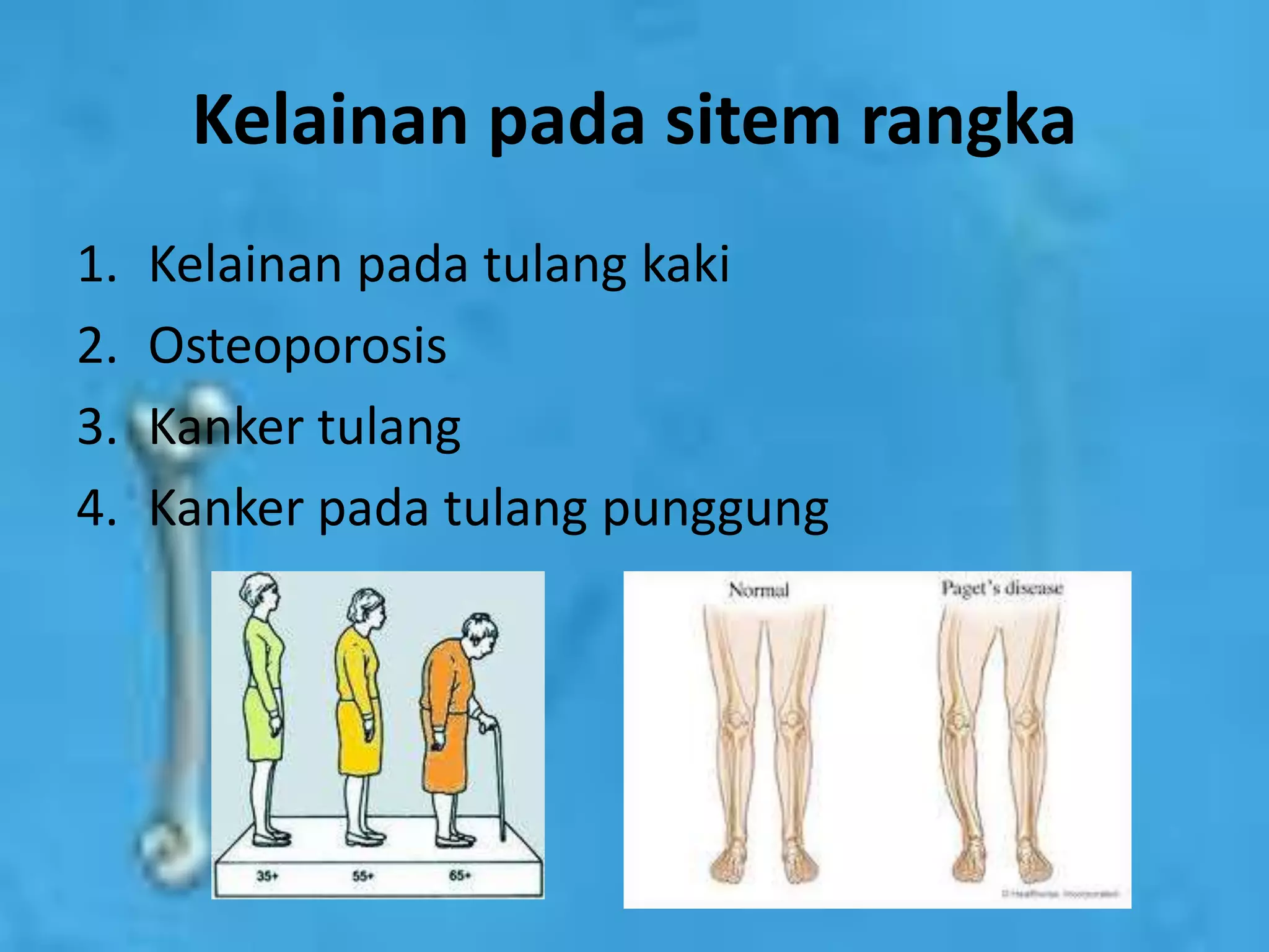 Sistem skeleton hewan vertebrata | PPTX