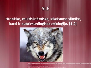 Sistemātiskā sarkanā vilkēde | PPTX