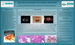 Sister mary joseph nodule the fungating umbilical mass | PDF