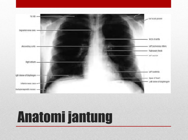 sist kardiovaskuler. jantung pembuluh darah | PPT