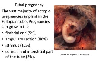 Sites of implantation of embryo | PPTX