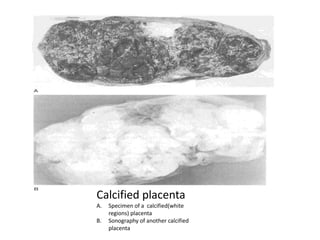 Sites of implantation of embryo | PPTX