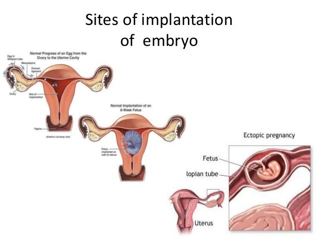 Sites of implantation of embryo
