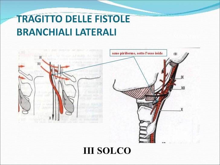 Cisti Congenite della testa e del collo