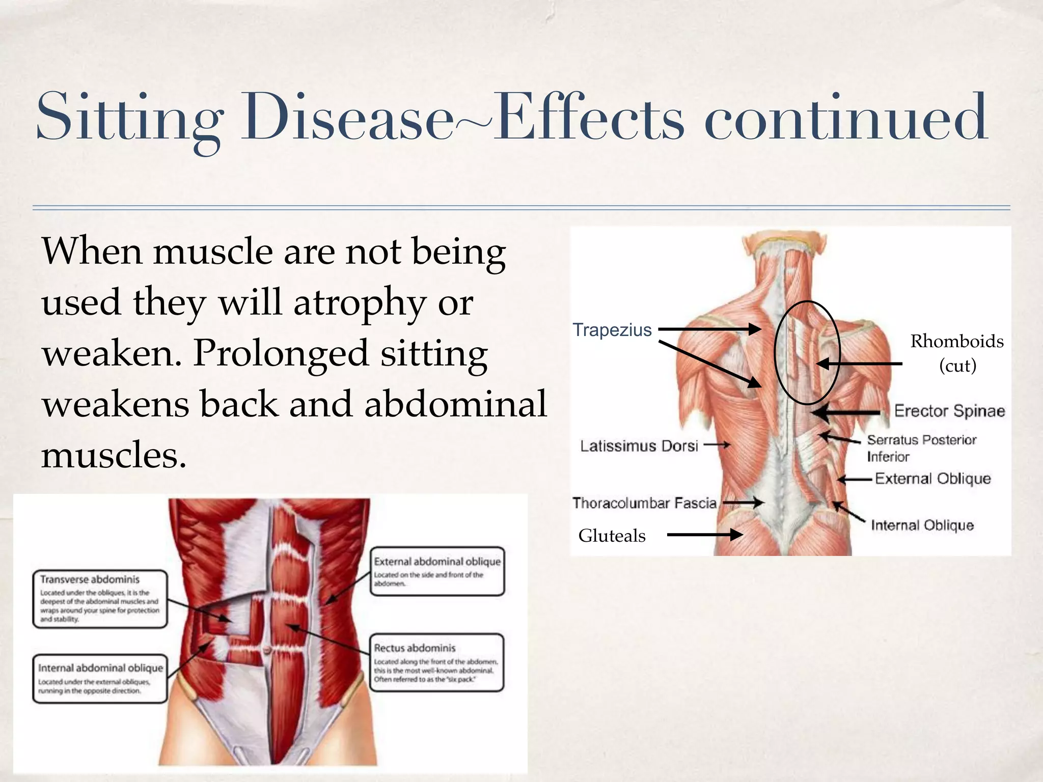Sitting Disease | PDF