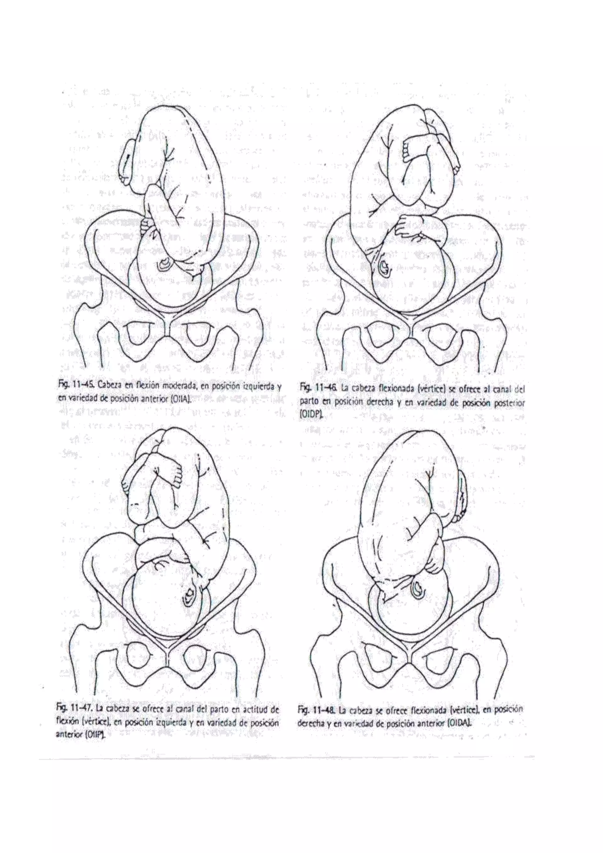 Situacion y posion fetal dibujos | PDF