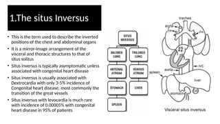 Situs anomalies presentation for Radiology | PPTX