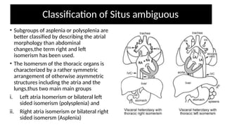 Situs anomalies presentation for Radiology | PPTX