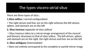Situs anomalies presentation for Radiology | PPTX