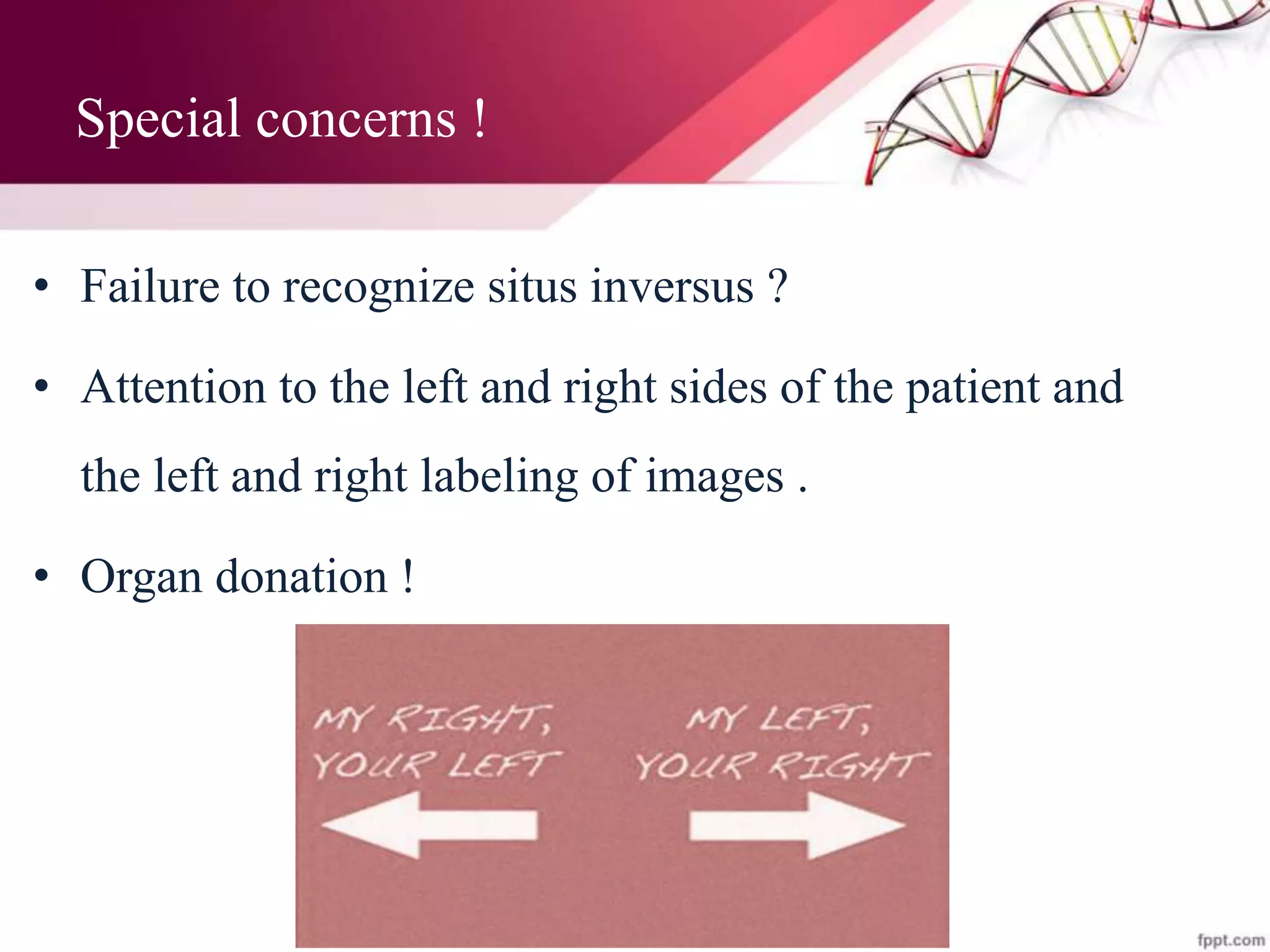 Situs inversus totalis | PPTX