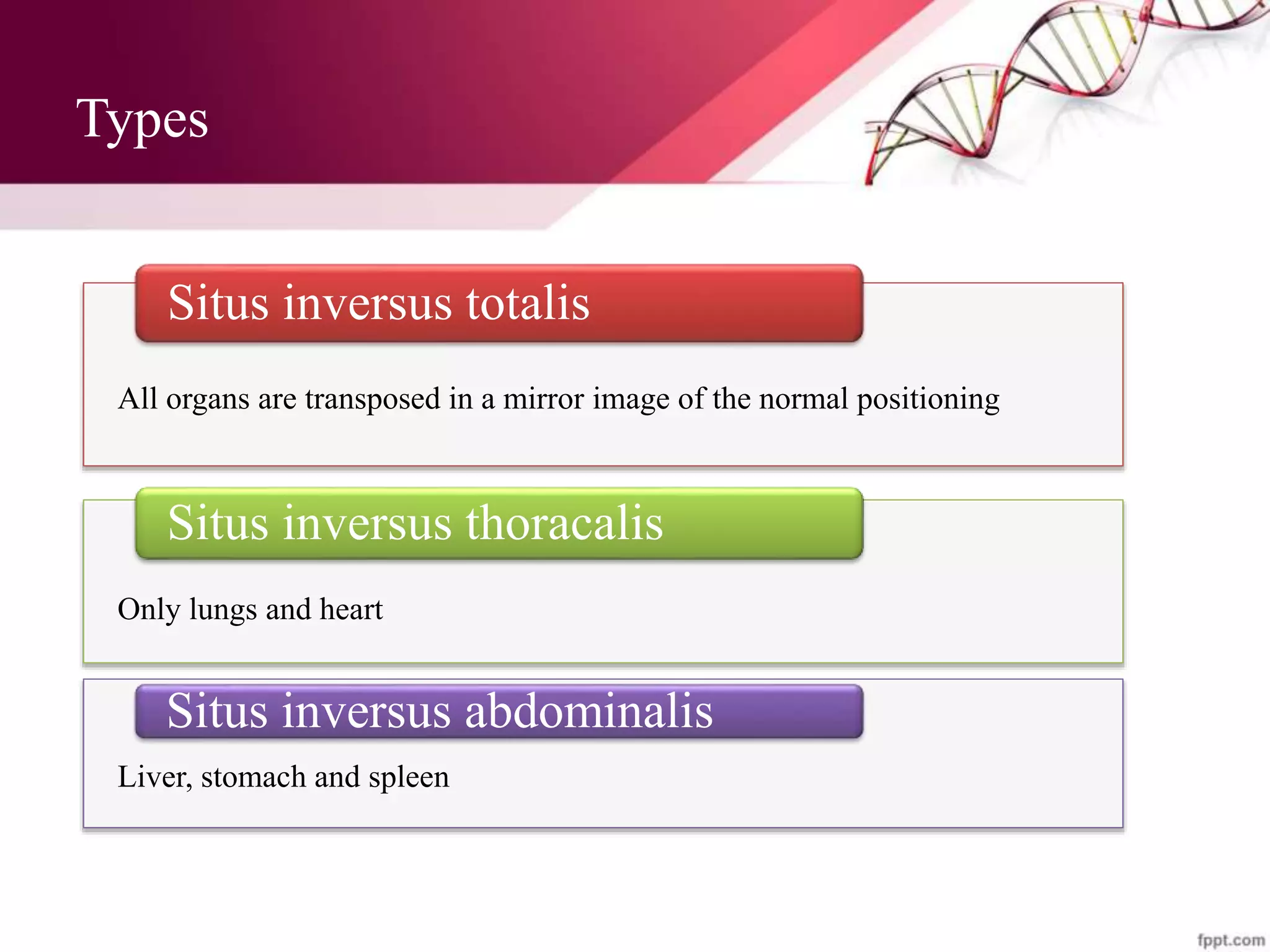 Situs inversus totalis | PPTX