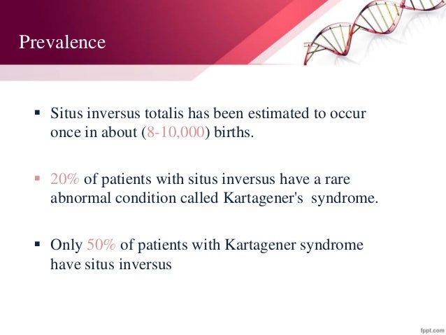Situs inversus totalis