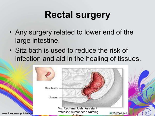 Sitz bath Procedure | PPTX
